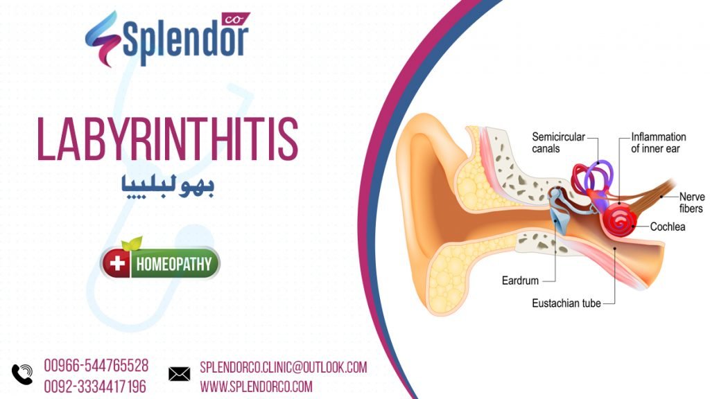 Homeopathic Medicine for Labyrinthitis