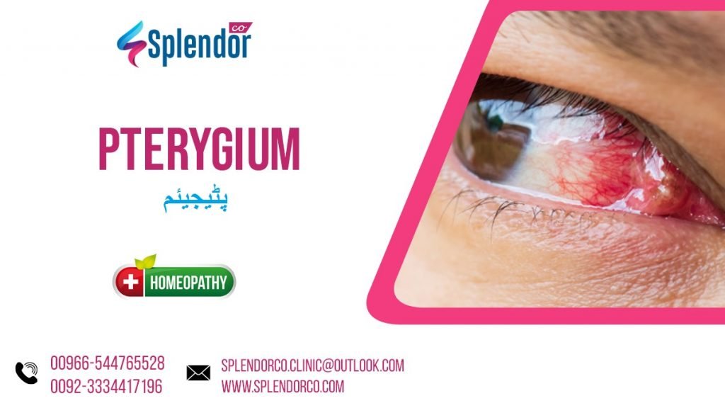 Homeopathy has a Natural Solution for Pterygium